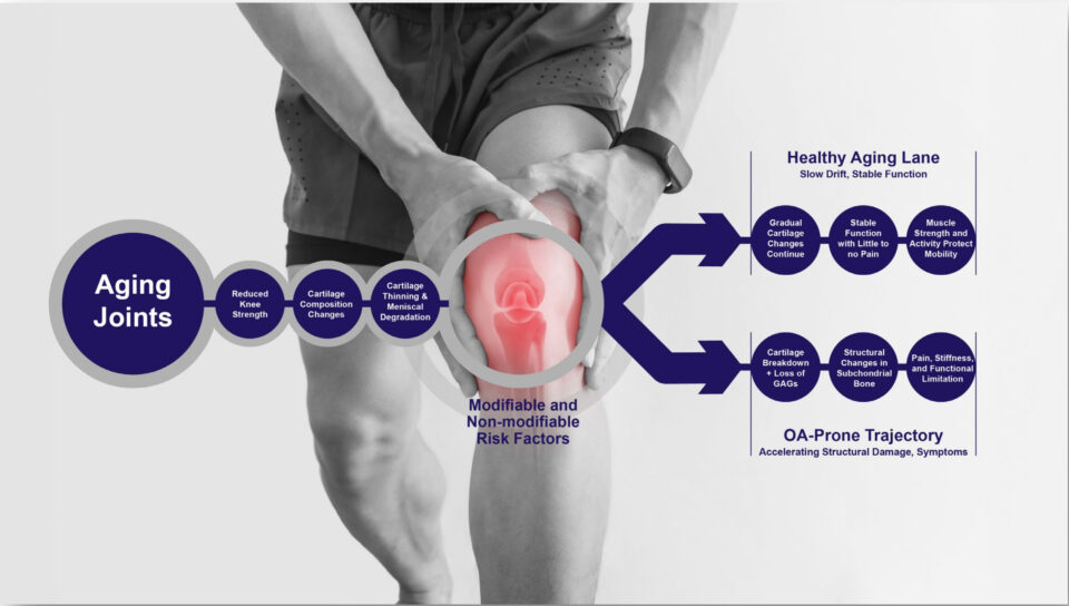 Kinexa: PLT Health's Whole-Joint Longevity Complex, Backed by MRI ...
