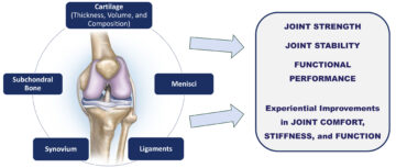 Kinexa: PLT Health's Whole-Joint Longevity Complex, Backed by MRI ...