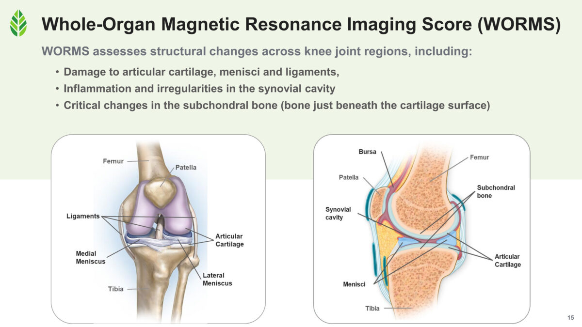 Kinexa: PLT Health's Whole-Joint Longevity Complex, Backed by MRI ...